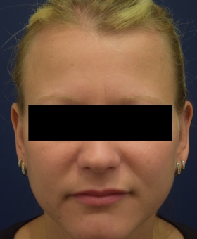 Before and After Gallery