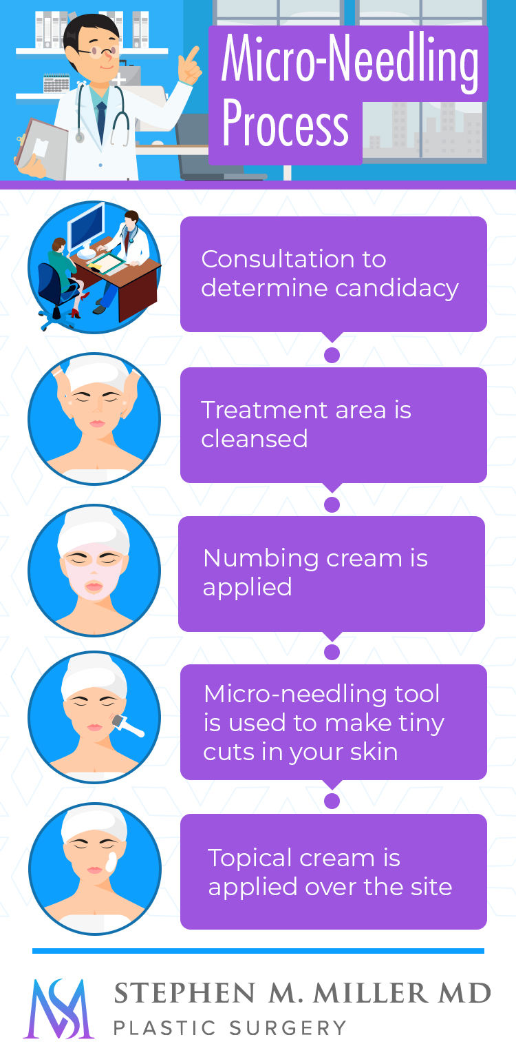 Does Micro-Needling Work on Stretch Marks? | Las Vegas, NV